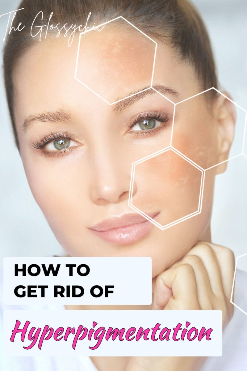 Get Rid Of Hyperpigmentation: Home Remedies That Work - The Glossychic